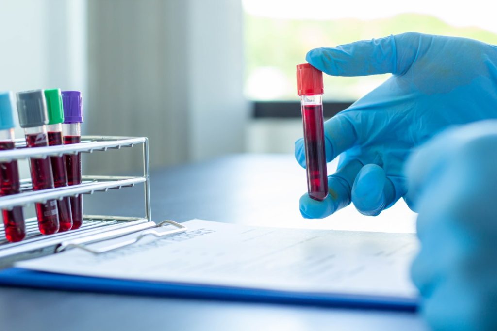 7 Reasons Why You Should Get Regular Blood Tests